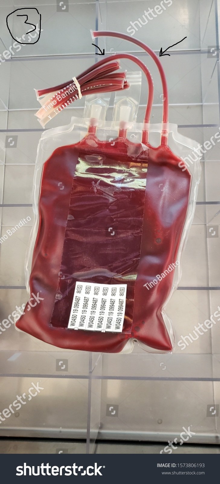 Be careful, the bag is now open! - Immumohematology Made Easy